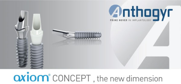 [ Trụ Implant Anthogyr ]: Xuất xứ, Ưu điểm, Giá thành