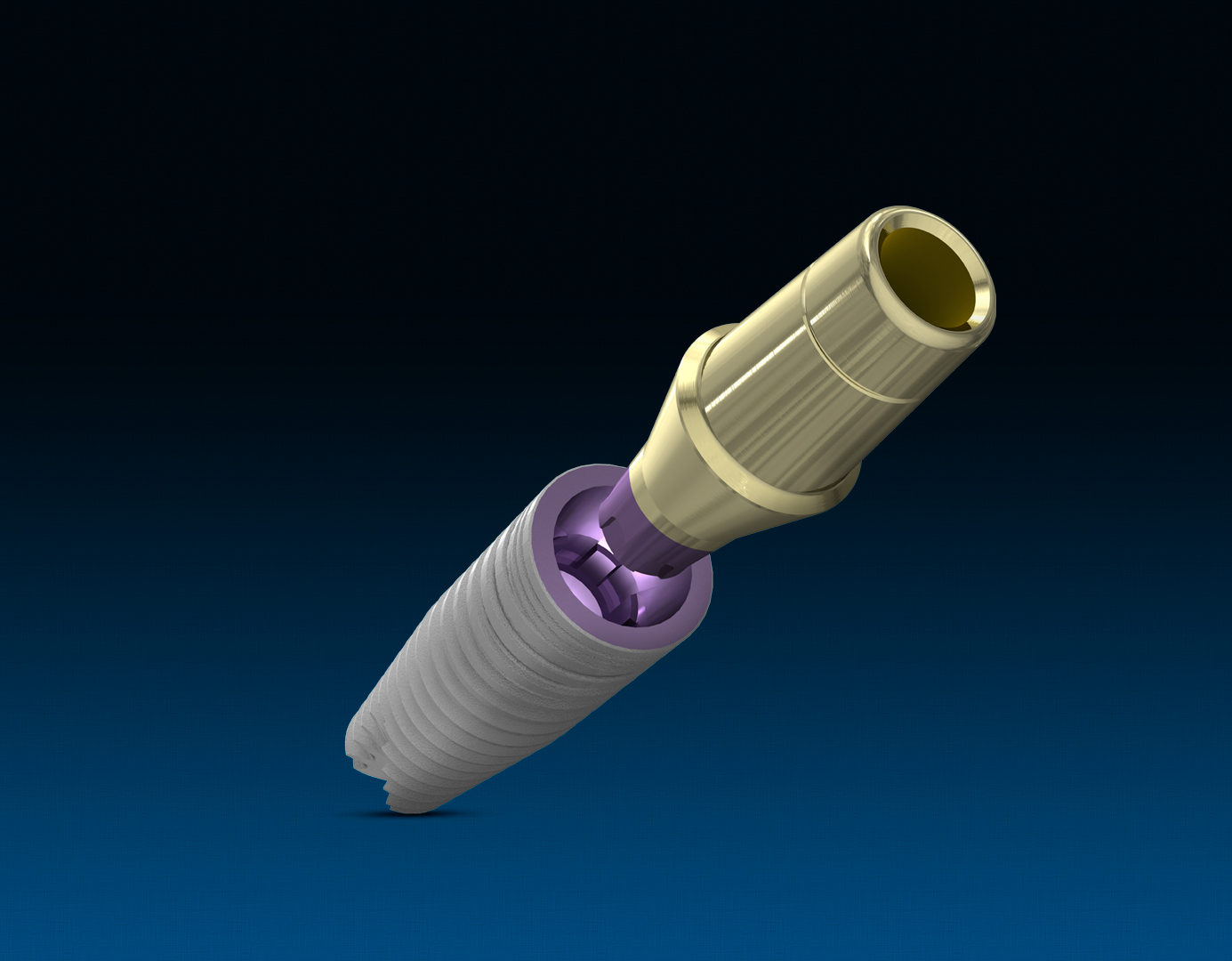 Từ A- Z thông tin về [ Trụ Implant Mis C1 ]: Ưu điểm, giá thành