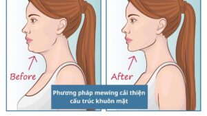 Mewing là gì ? Cách tập mewing chi tiết và lưu ý khi tập