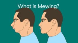 Mewing là gì ? Cách tập mewing chi tiết và lưu ý khi tập